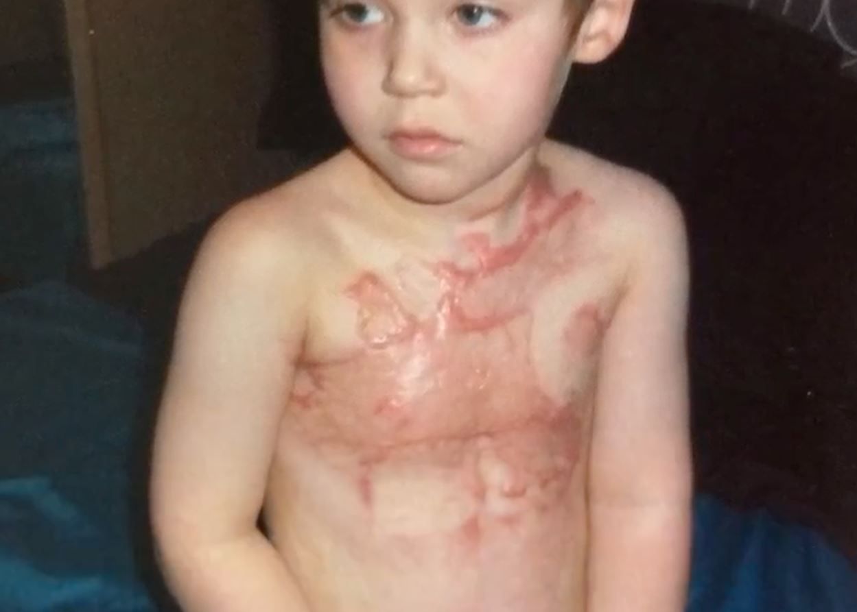 Families warned against holding private firework displays