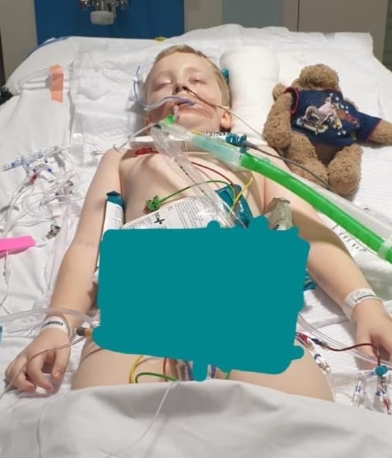 10-year-old Scottish boy in coma after catching COVID-19 | News ...