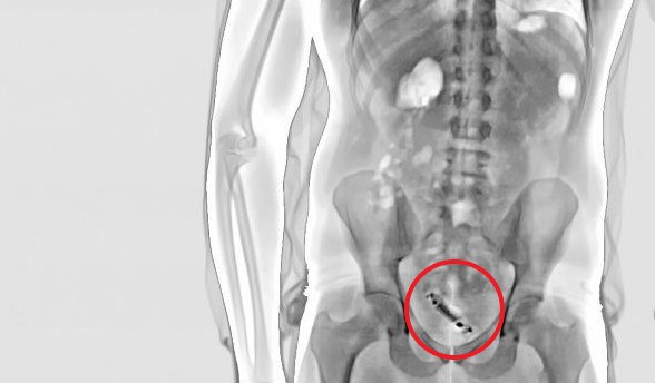 New X-Ray prison scanners installed in Norfolk and Suffolk