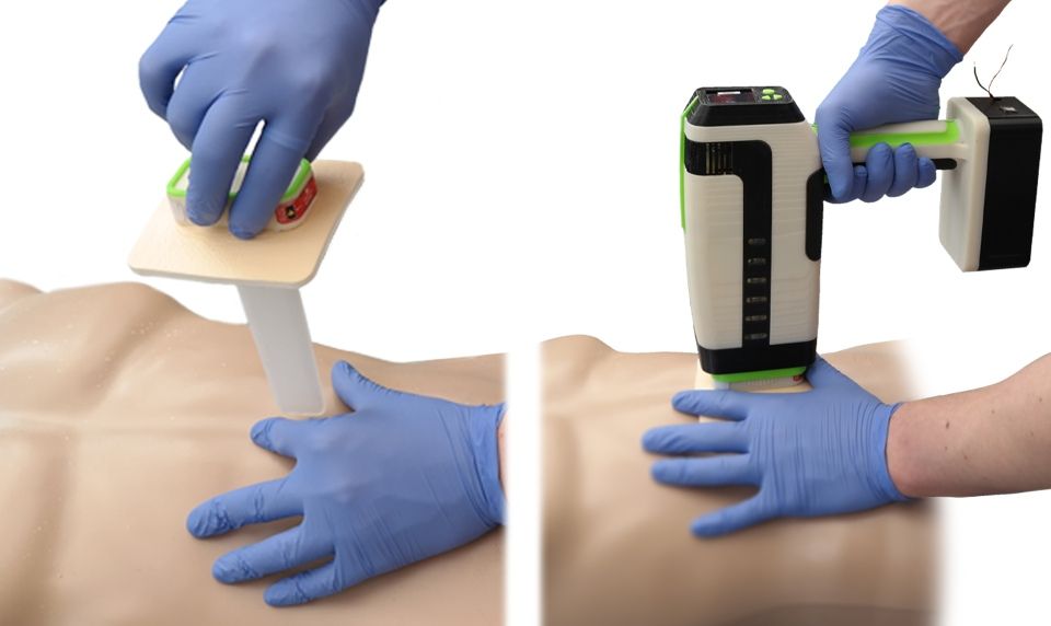Loughborough student designs life-saving device to control stab wound ...