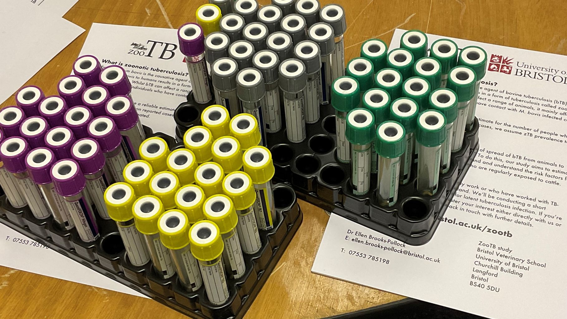 First study into Bovine TB's transmission to humans | News - Greatest ...