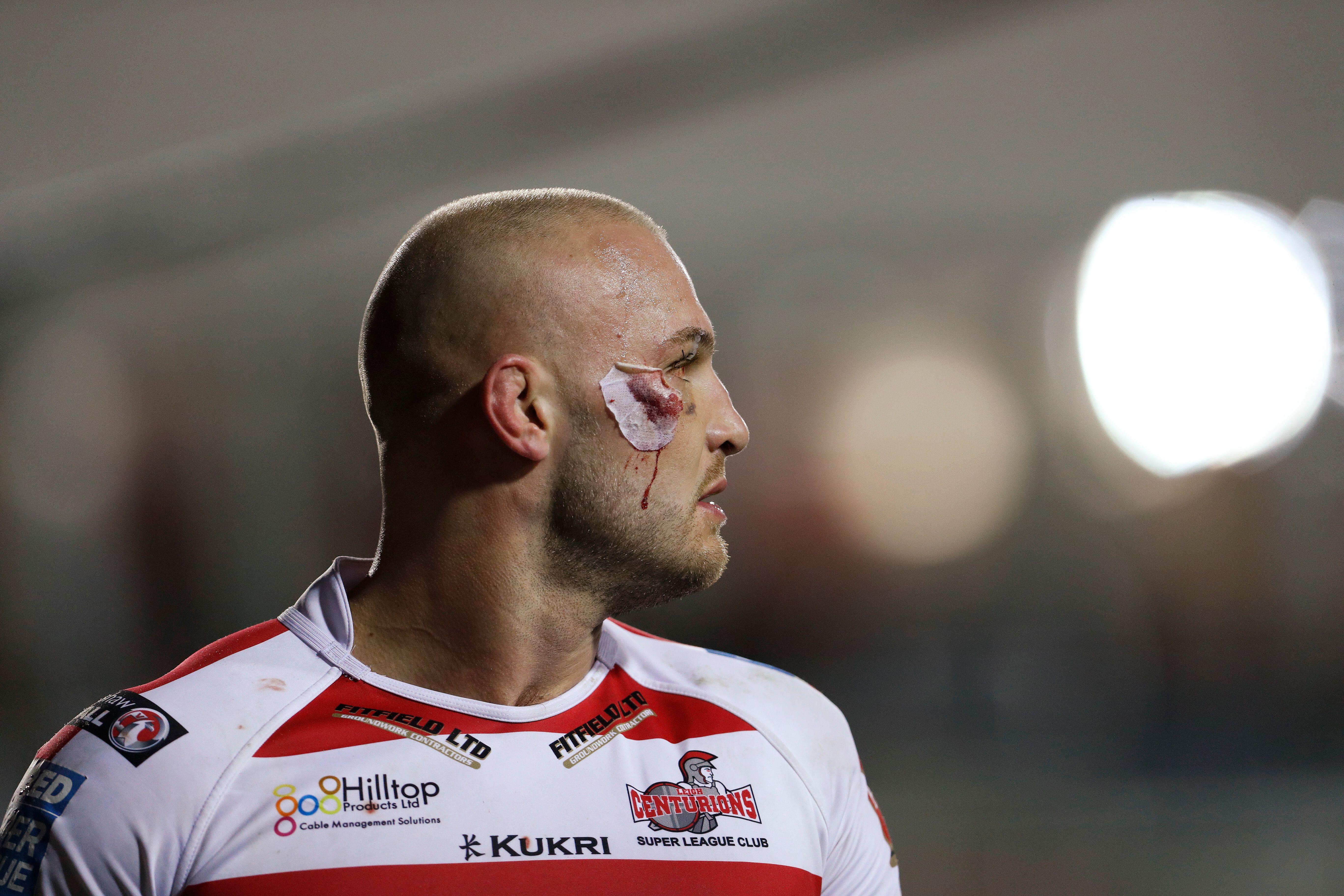 The former rugby player aiming to improve kids mental health through ...