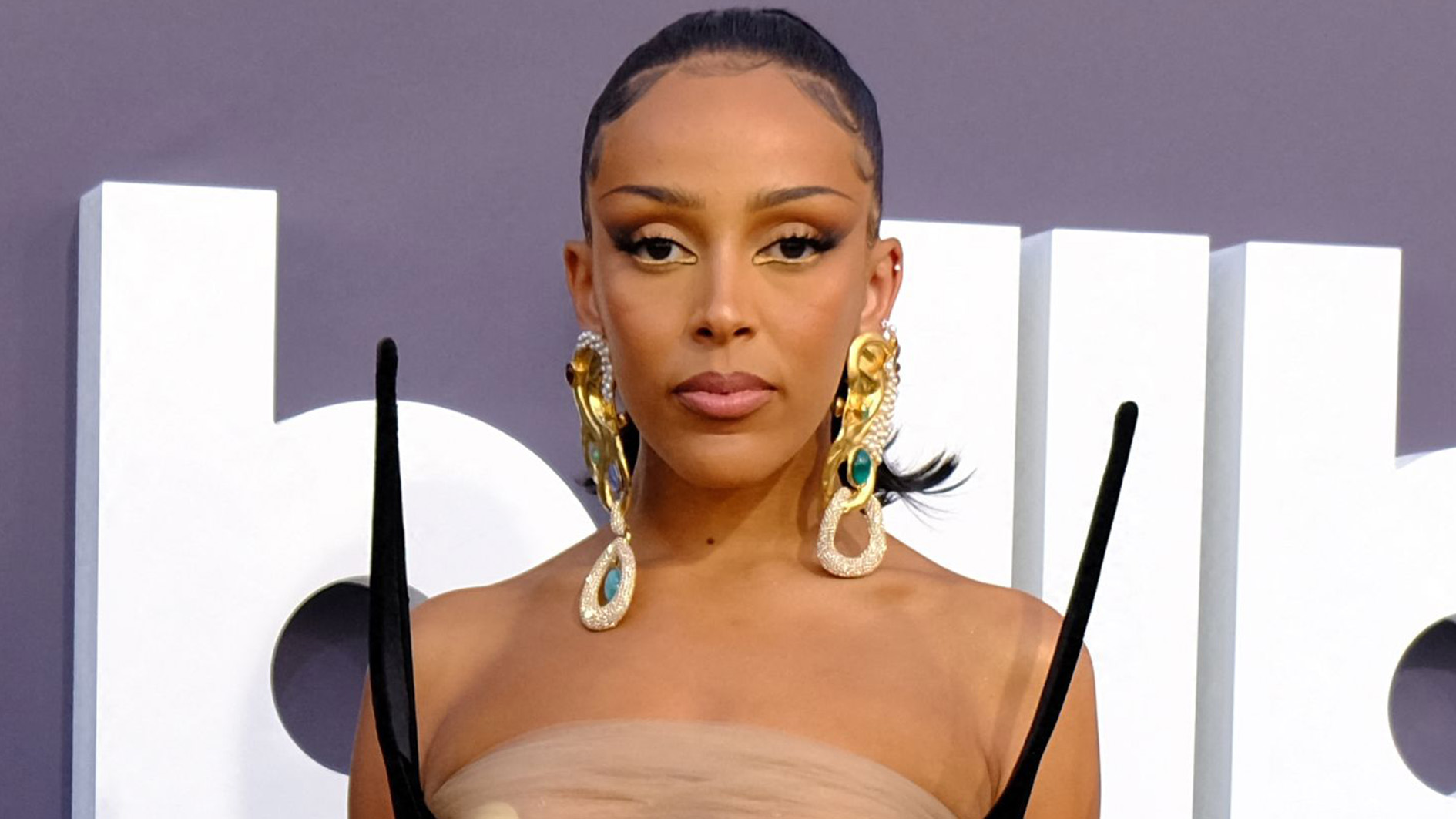 Doja Cat updates fans on throat surgery