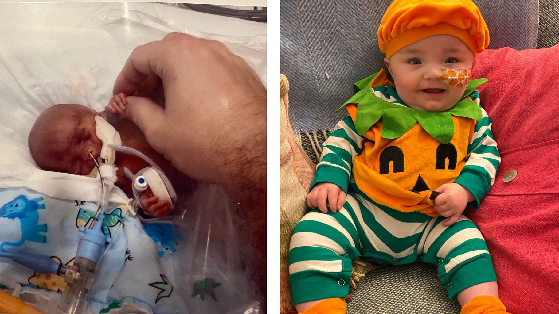 Leith Mum speaks about her miracle baby on prematurity awareness day