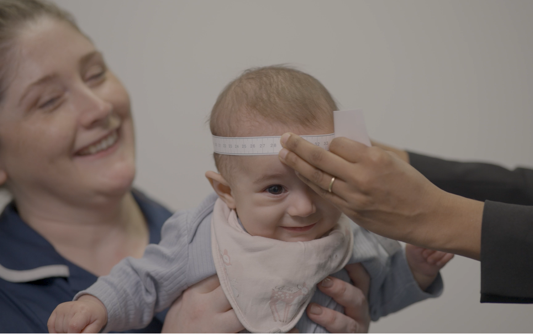 Hydrocephalus Baby Before And After