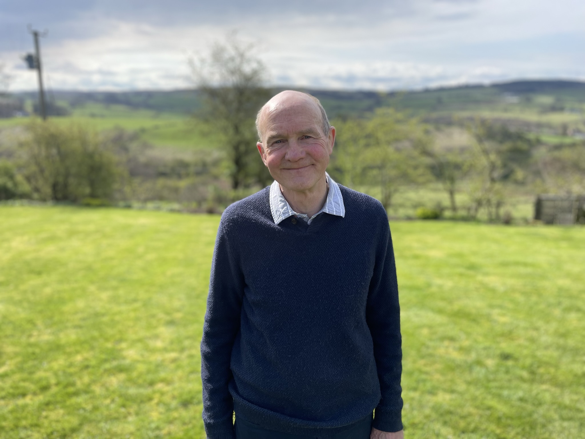 'My face was badly burnt': Man backs Beatson appeal for research on ...