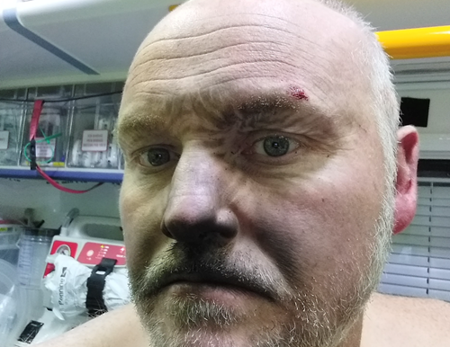 Police officer speaks out after being engulfed in flames during Villa ...