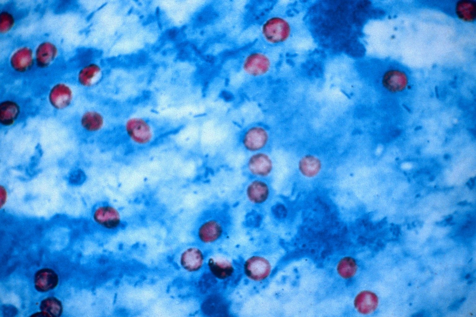 Expert warns parasite outbreak in South Devon could last two more weeks