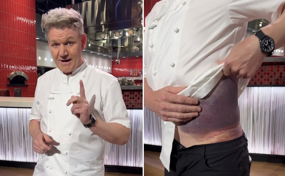 Scottish chef Gordon Ramsay is "lucky to be here" after bike accident.