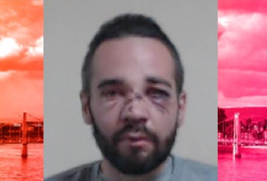 Sisters of Skye shooting victim condemn 'evil' killer