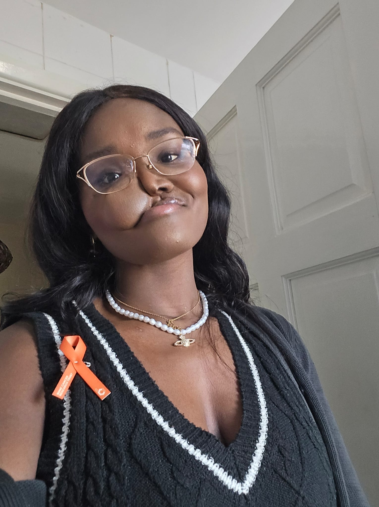 Birmingham woman calls for more representation of people with visible ...