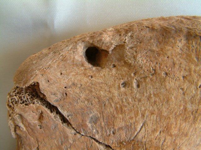 Skeleton shows proof of gladiators fighting lions in York