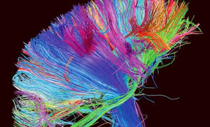 Madness Muse Video