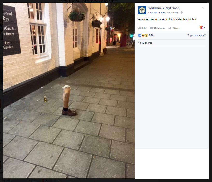 Photo of fake leg left in Doncaster goes viral | News - Greatest Hits ...